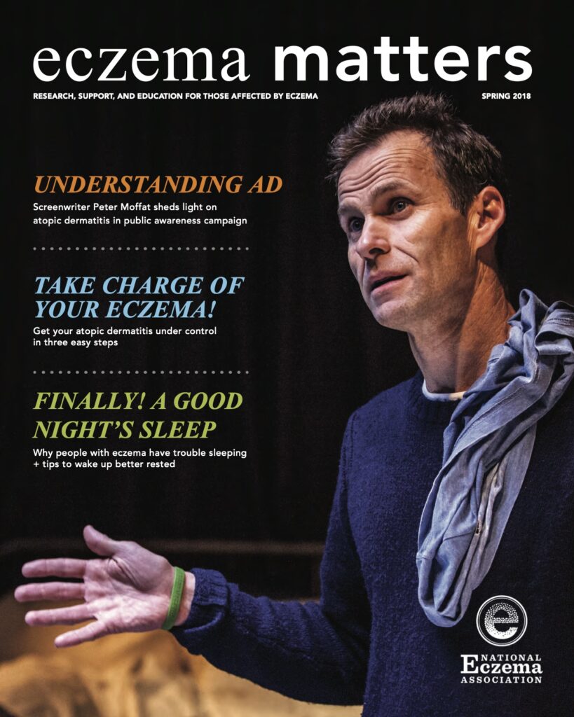NEA Magazine - Spring 2018 | National Eczema Association