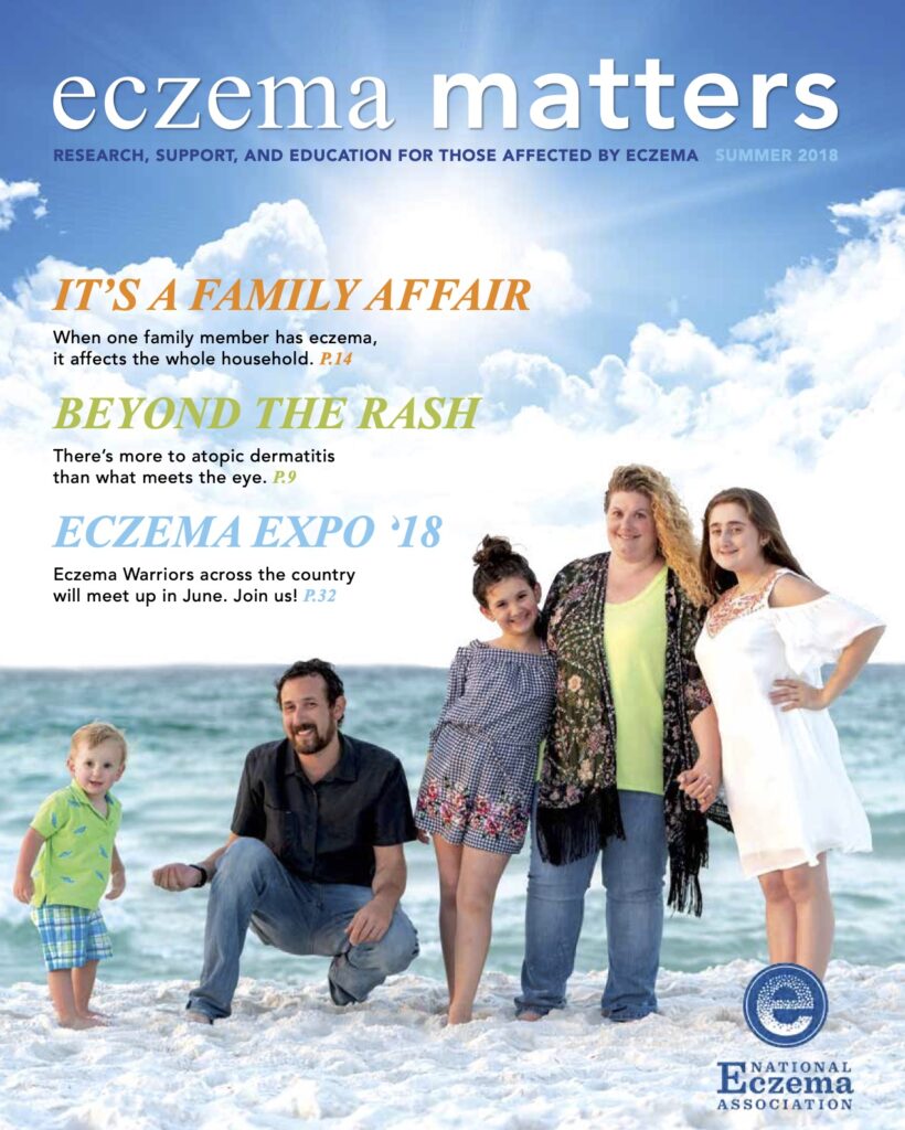 NEA Magazine - Summer 2018 | National Eczema Association