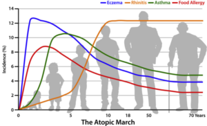 The Atopic March: How Eczema Can Lead to Allergies and Asthma ...