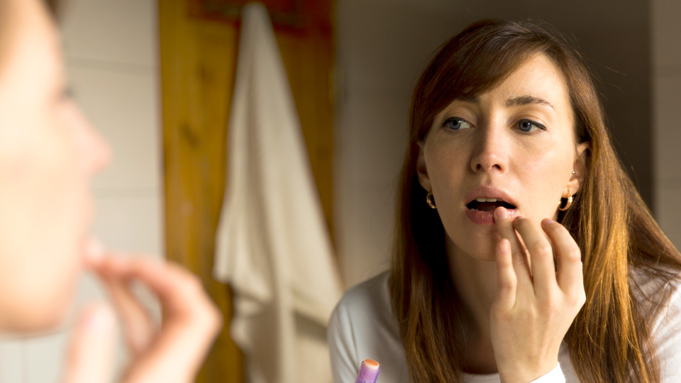 How to Take Care of Your Lips When You Have Eczema | National Eczema ...
